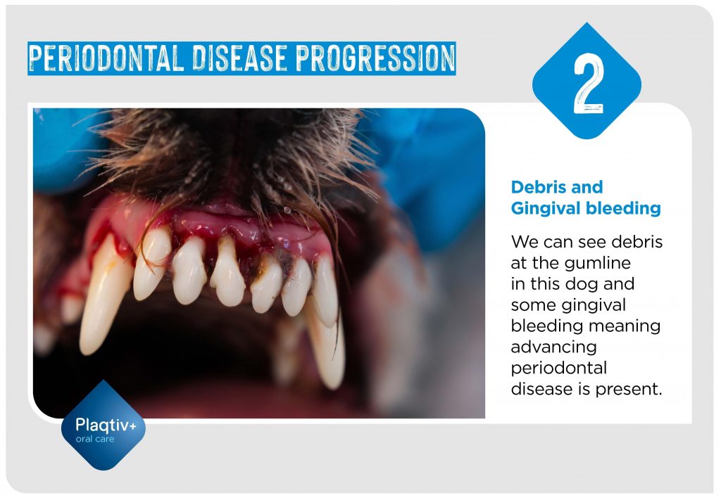 Plaqtiv+A4-icky teeth-progression 2-min | The PAC